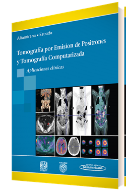 Altamirano Ley Javier. Tomografía por Emisión de Positrones y Tomograf – LIBRERÍA UNIVERSO MÉDICO