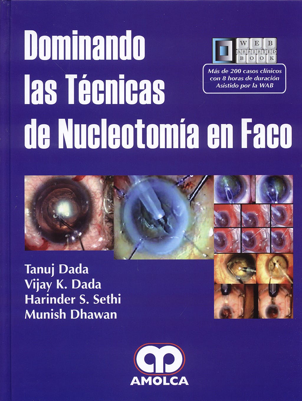 Tanuj Dada. Dominando las Técnicas de Nucleotomía en FACO. 1ra ed. 200 ...