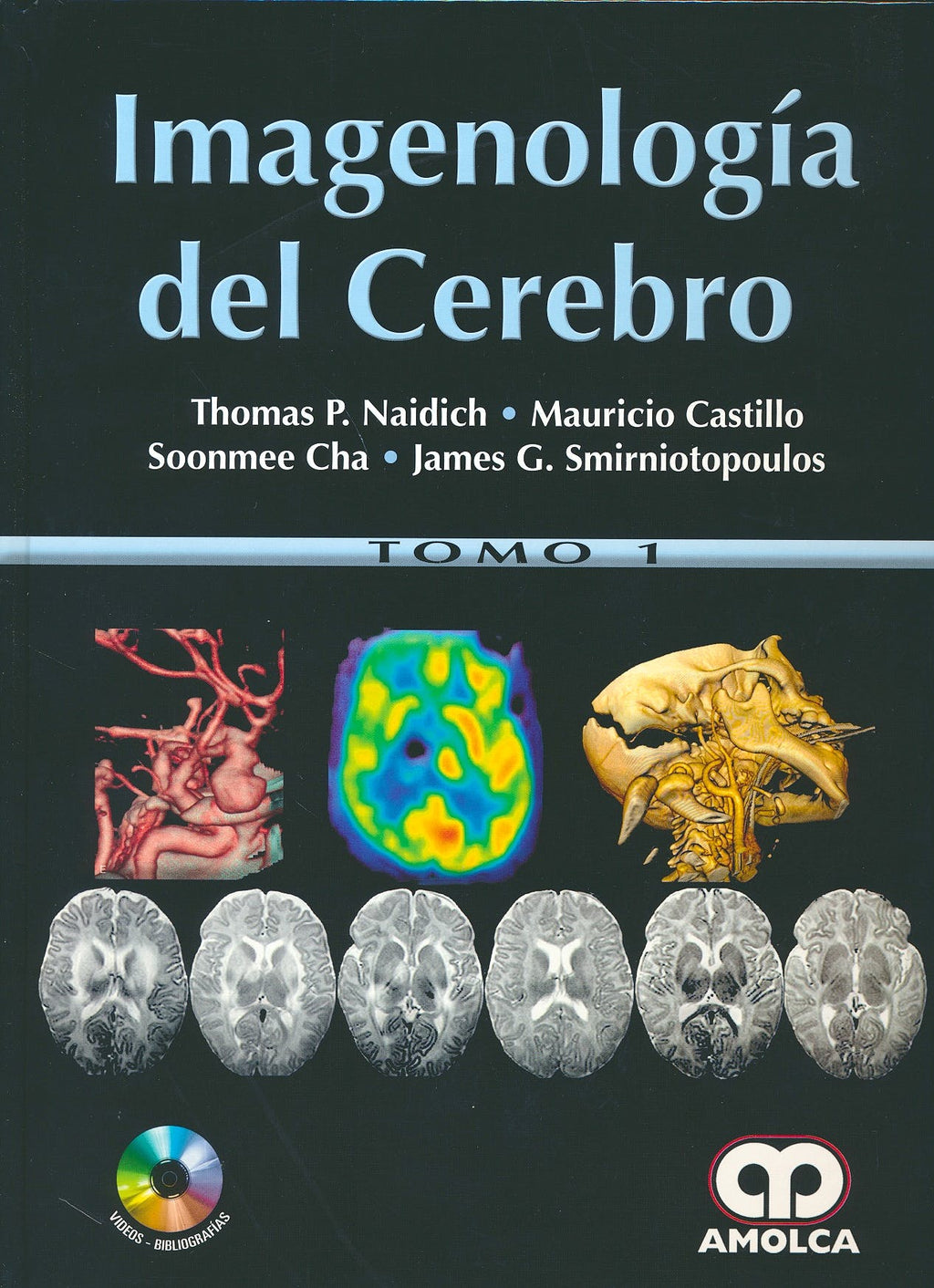 Thomas P. Naidich. Imagenología del Cerebro. Tomos I - II. 1a. ed ...