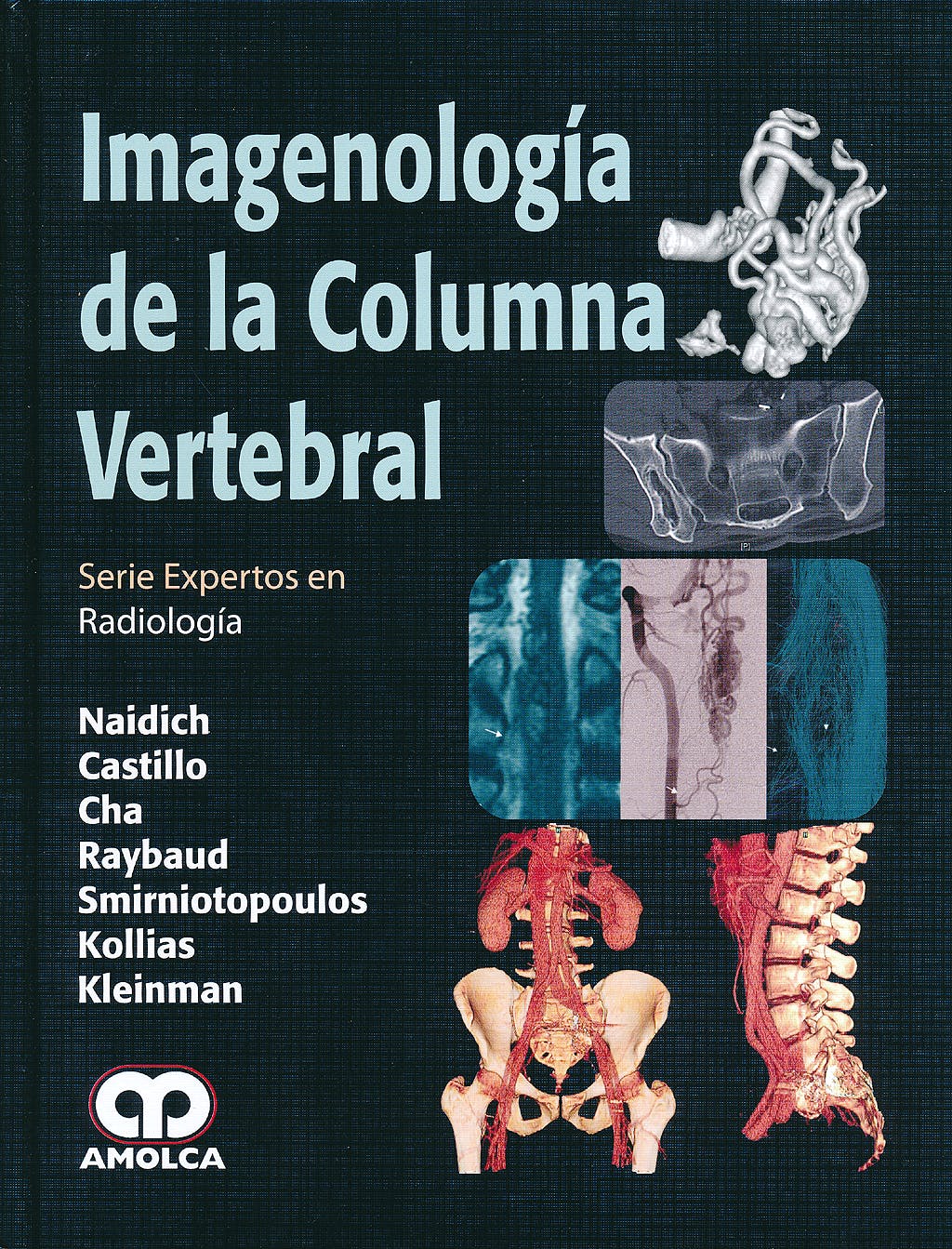 Thomas P. Naidich. Imagenología de la Columna Vertebral. 1a. ed. 2013 ...